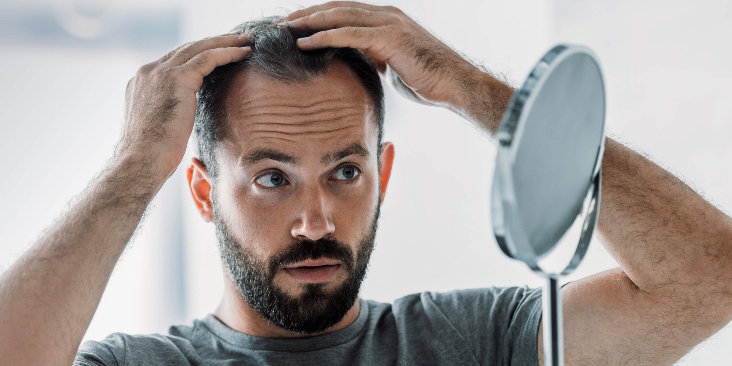 Receding Hairline: Causes, treatments, and prevention
