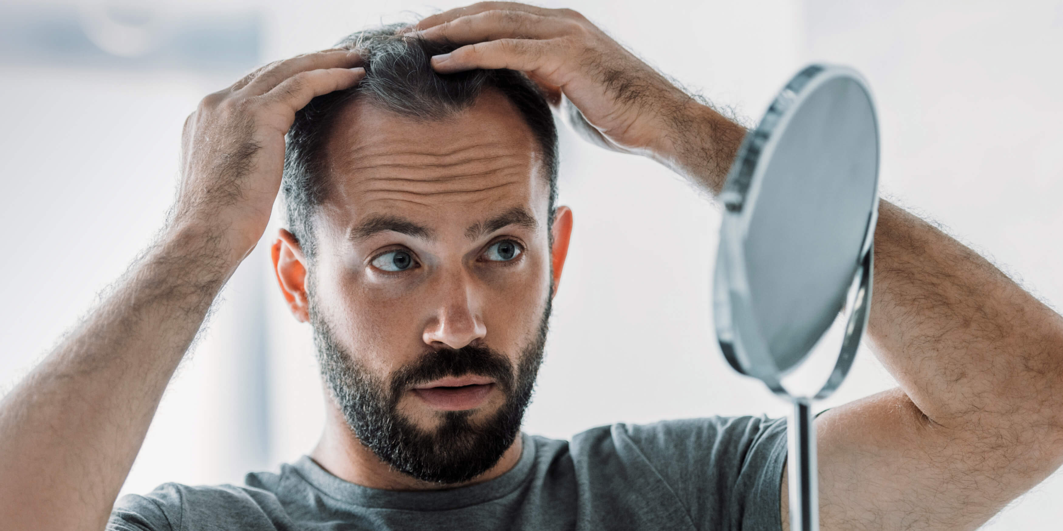 Receding Hairline: Causes, treatments, and prevention
